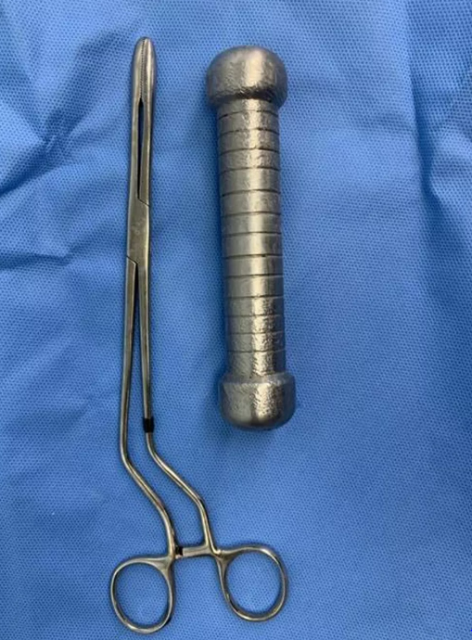 Homem que ficou com peso de academia de 2kg preso no reto é tema de ...